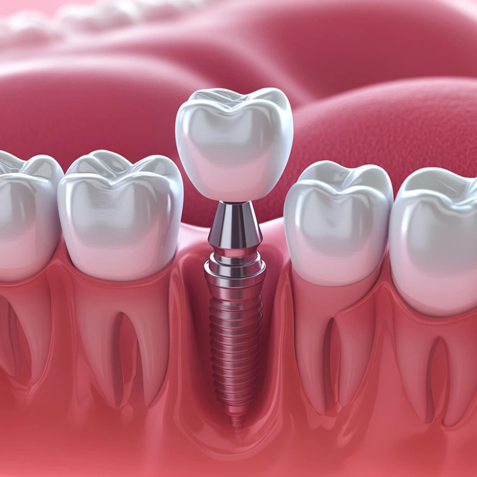 Oral Surgery & Dental Restoration in South Bend